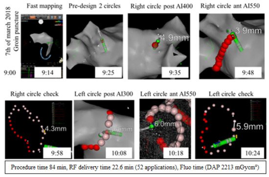 How Close Are We toward an Optimal Balance in Safety and Efficacy in ...