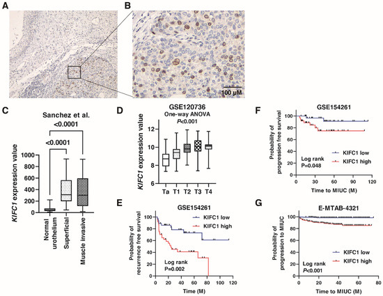 KIFC1 Is Associated with Basal Type, Cisplatin Resistance, PD-L1 ...