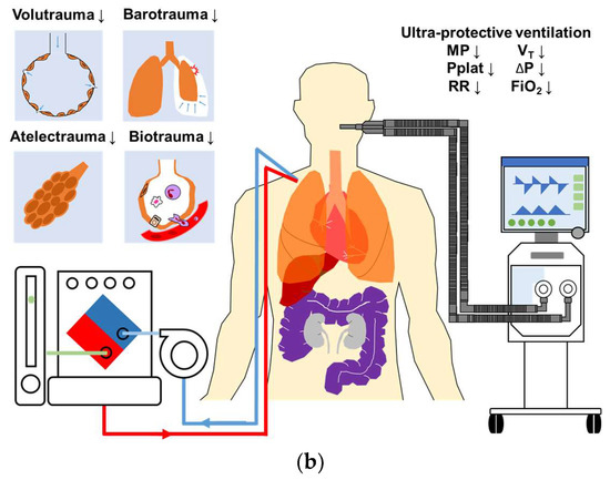 Mechanical Ventilation during Extracorporeal Membrane Oxygenation in ...