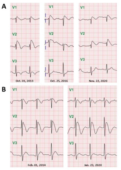 JCM | Free Full-Text | Long-Term Prognosis of Febrile Individuals with ...