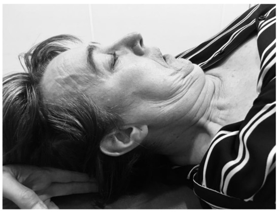 Myofascial Induction Therapy Improves the Sequelae of Medical Treatment ...