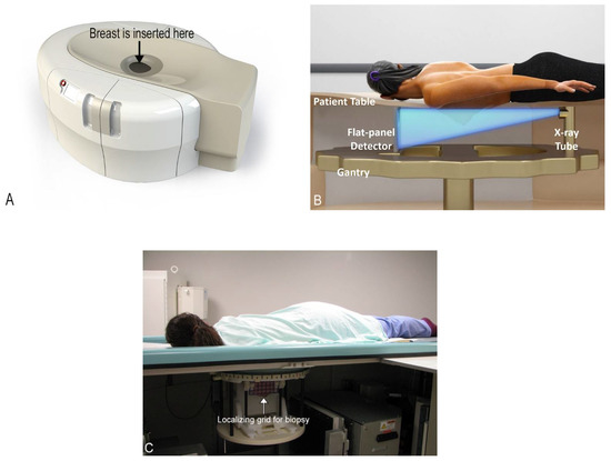 Cone-Beam Breast Computed Tomography: Time for a New Paradigm in Breast ...