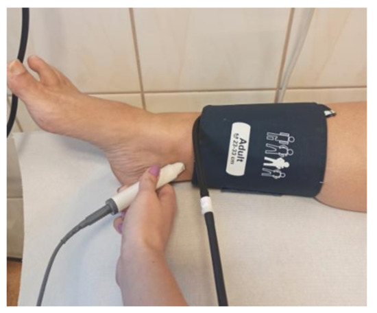 Automated Measurements of Ankle-Brachial Index: A Narrative Review