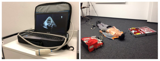 U SO CARE—The Impact of Cardiac Ultrasound during Cardiopulmonary ...