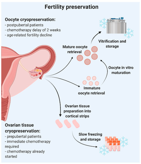 Jcm Free Full Text Fertility Preservation How To Preserve Ovarian