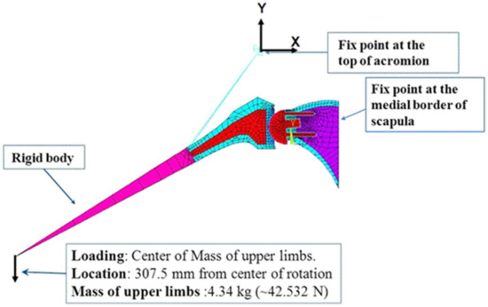 Complications of Reverse Total Shoulder Arthroplasty: A Computational ...
