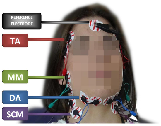 The Influence of Visual Input on Electromyographic Patterns of ...