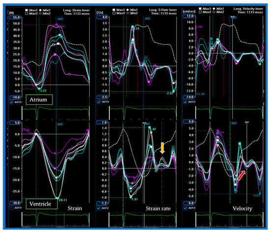 Mid-Diastolic Events (L Events): A Critical Review