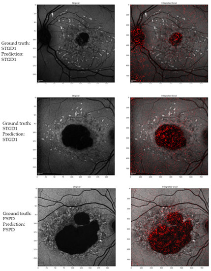 Deep Learning to Distinguish ABCA4-Related Stargardt Disease from PRPH2 ...