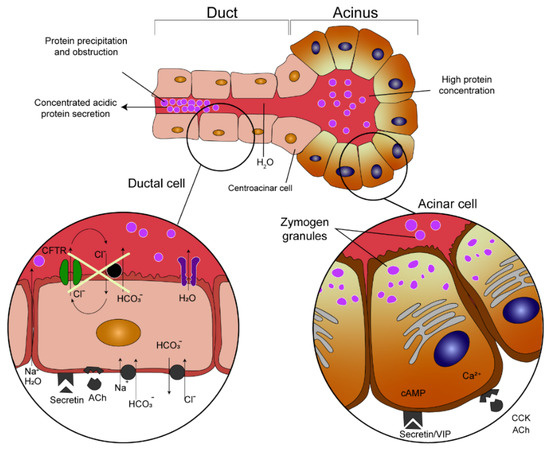 Causes of Exocrine Pancreatic Insufficiency Other Than Chronic Pancreatitis