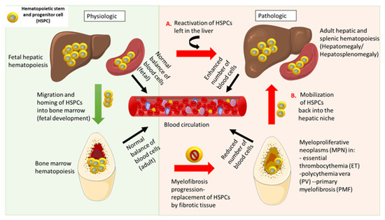 Extramedullary Hematopoiesis of the Liver and Spleen