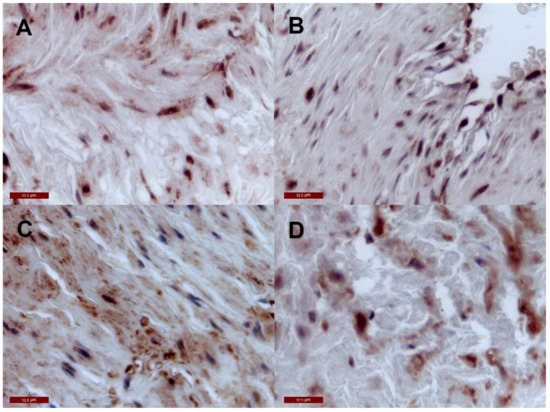 The Active Isoforms of MGP Are Expressed in Healthy and Varicose Veins ...