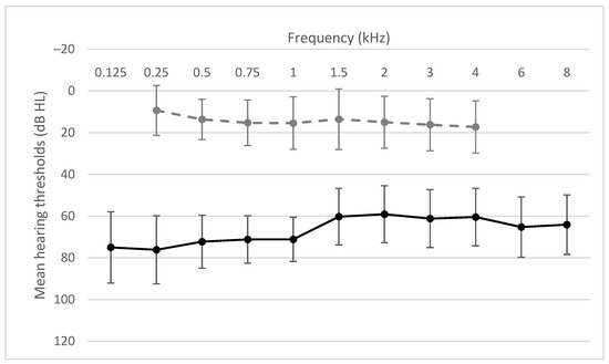JCM | Free Full-Text | The Bonebridge BCI 602 Active Transcutaneous ...