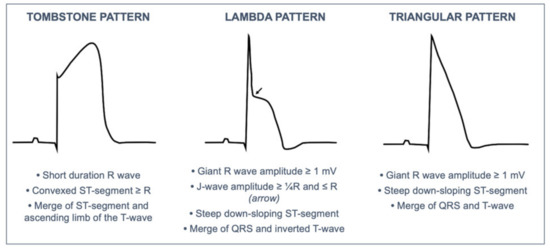 St Elevation Tombstone