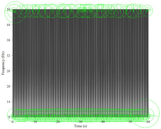 JCM | Free Full-Text | Sleep Apnea Classification Algorithm Development Using a Machine-Learning ...