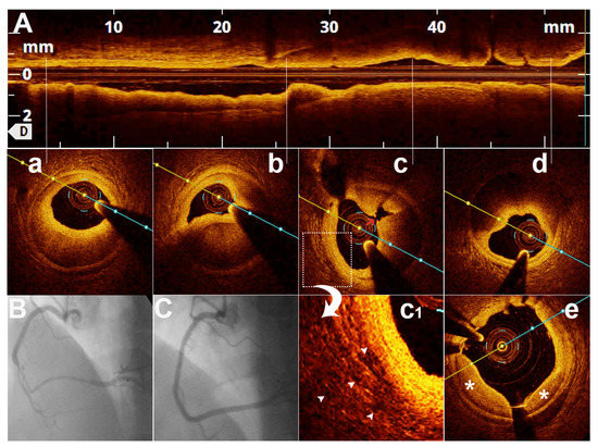 Optical Coherence Tomography—OCT for Characterization of Non ...