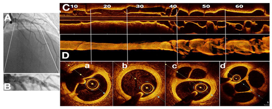 Optical Coherence Tomography—OCT for Characterization of Non ...