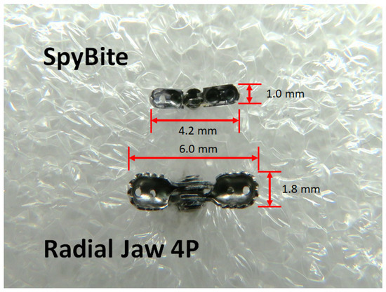 Peroral Cholangioscopy-Guided Targeted Biopsy versus Conventional ...