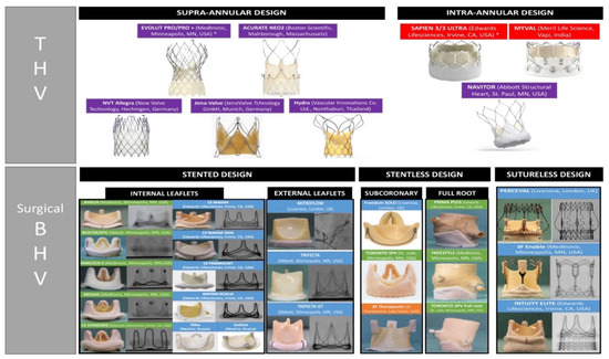 Trans-Catheter Valve-in-Valve Implantation for the Treatment of Aortic ...