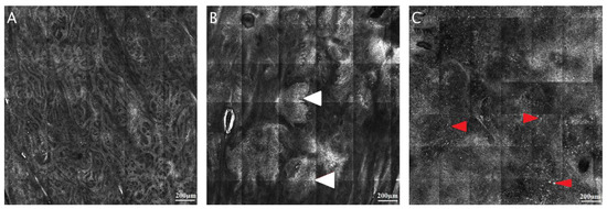 Artificial Intelligence-Based Approaches to Reflectance Confocal ...
