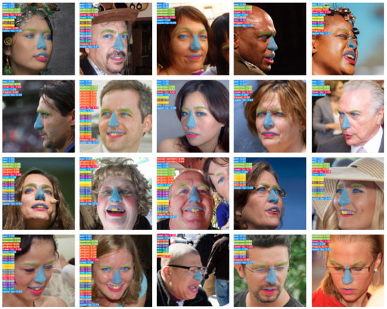 Evaluating the Precision of Automatic Segmentation of Teeth, Gingiva ...