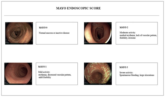 Evolution and New Horizons of Endoscopy in Inflammatory Bowel Diseases