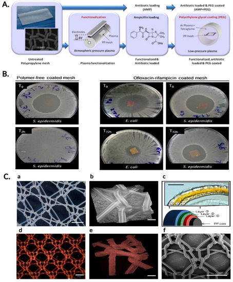 Antimicrobial Meshes for Hernia Repair: Current Progress and Perspectives