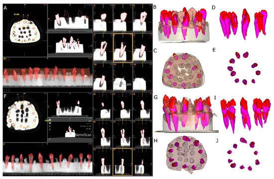 Influence of Static Navigation Technique on the Accuracy of ...