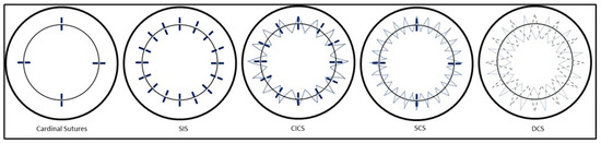 Update on Suture Techniques in Corneal Transplantation: A Systematic Review