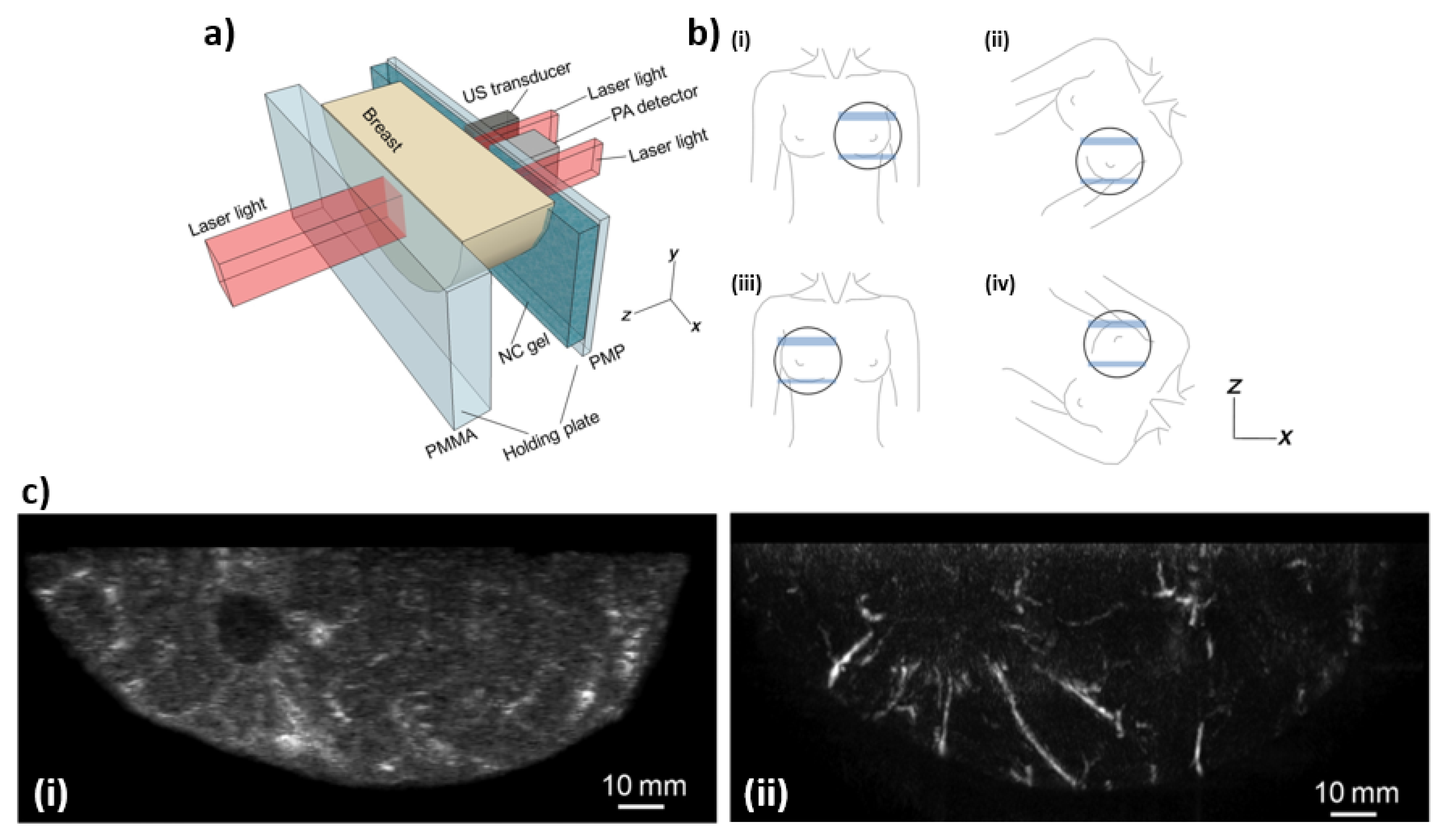 JCM | Free Full-Text | Ultrasound and Photoacoustic Imaging of Breast ...