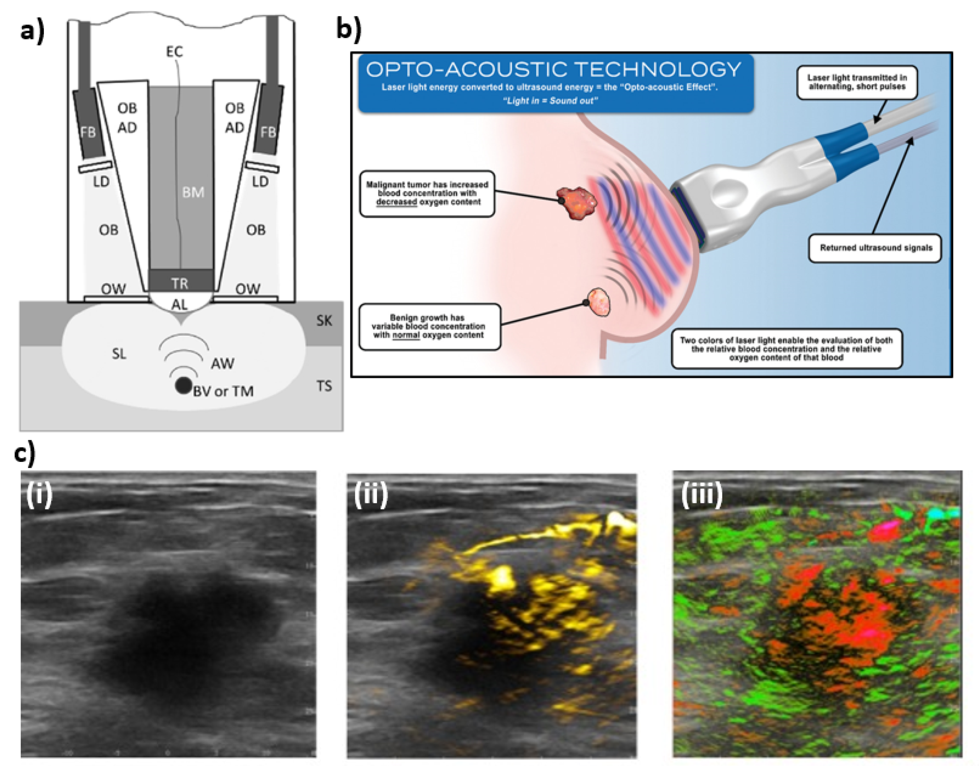 Ultrasound and Photoacoustic Imaging of Breast Cancer: Clinical Systems ...