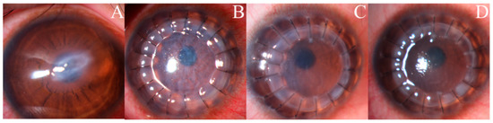 JCM | Special Issue : Advances in the Diagnosis and Treatment of Ocular ...