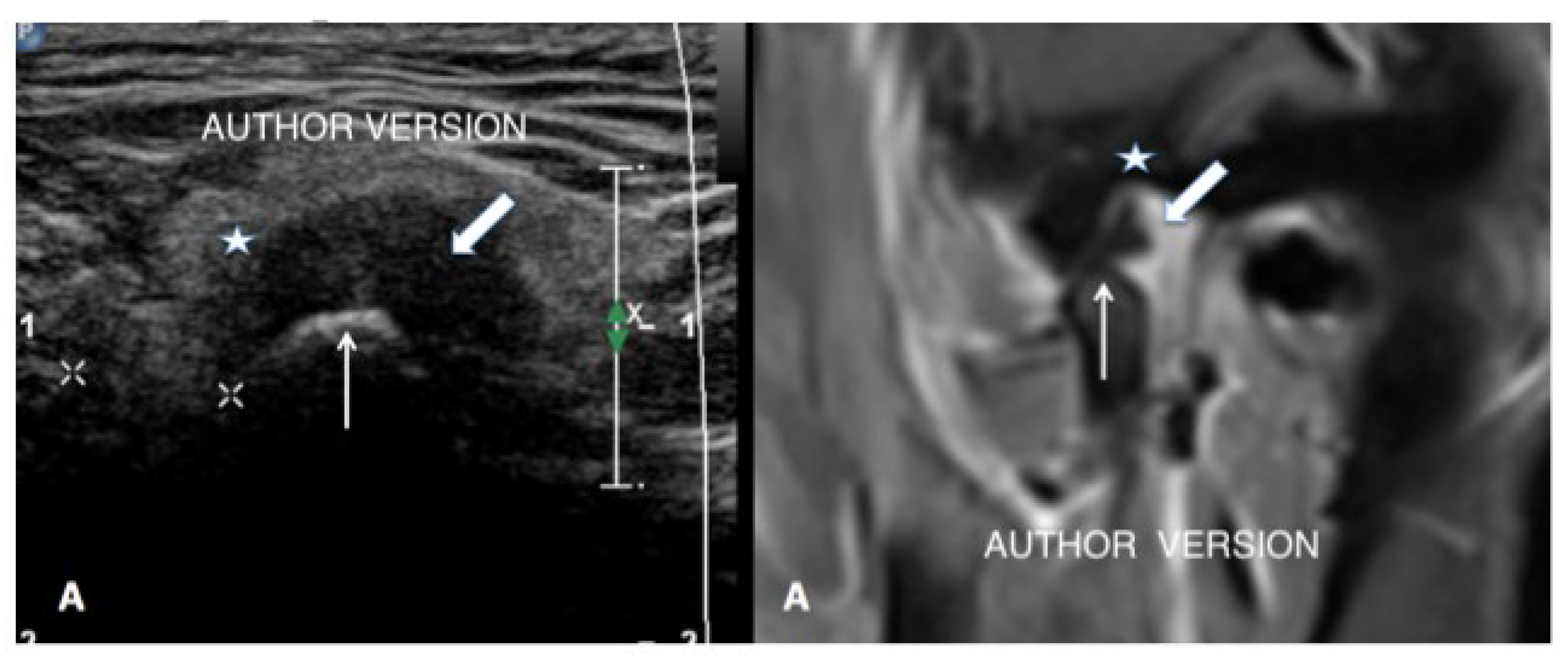 Jcm Free Full Text Influence Of Ultrasound Examination On Diagnosis