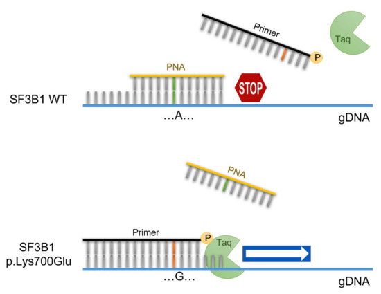 Detection of SF3B1 p.Lys700Glu Mutation by PNA-PCR Clamping in Myelodysplastic Syndromes and ...