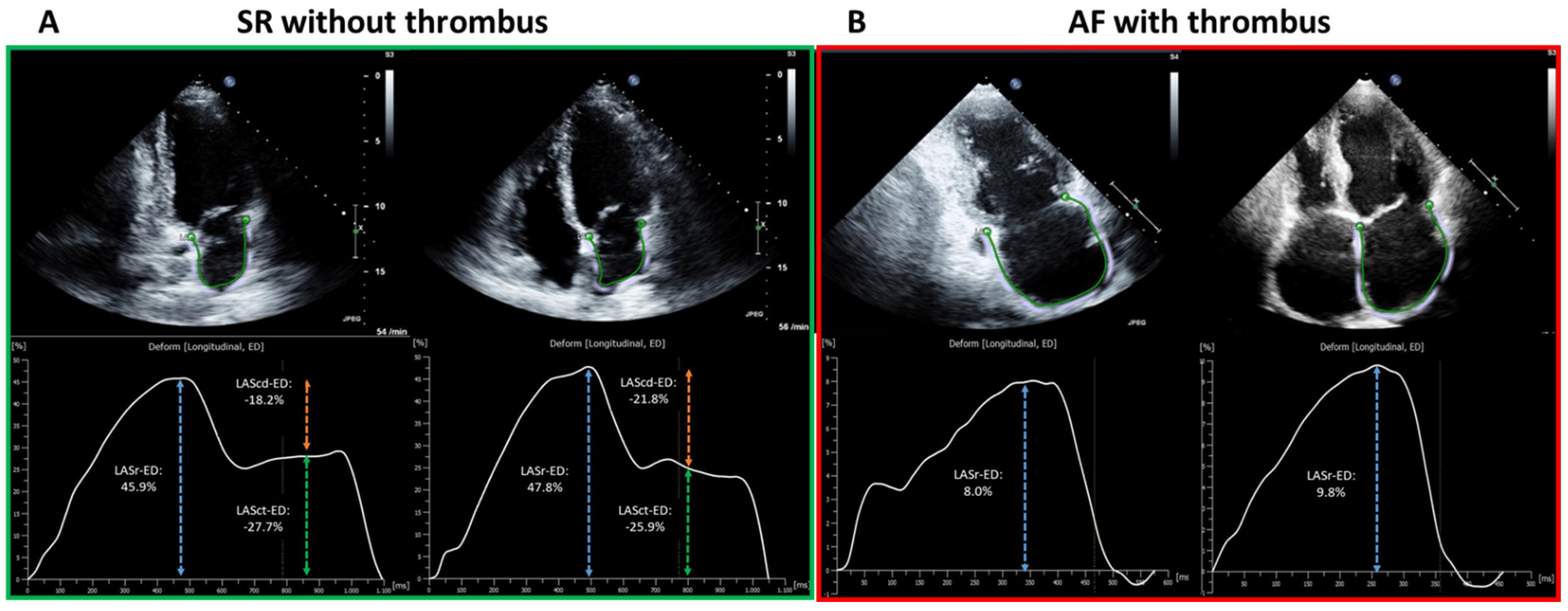 Jcm Free Full Text Echocardiographic And Electrocardiographic