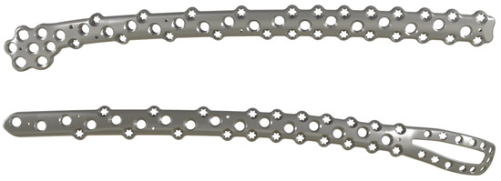 Peri- and Interprosthetic Femoral Fractures—Current Concepts and New ...