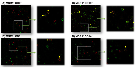 JCM | Free Full-Text | Expression of Macrophage Scavenger Receptor ...