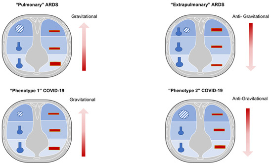 JCM | Free Full-Text | Different Methods to Improve the Monitoring of ...