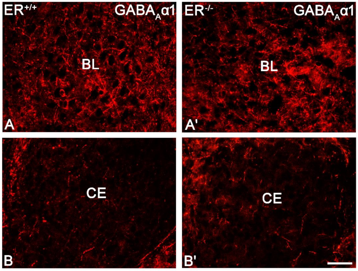 JCM | Free Full-Text | Expression of Calbindin, a Marker of Gamma ...