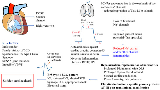 Pathogenesis and Management of Brugada Syndrome: Recent Advances and ...