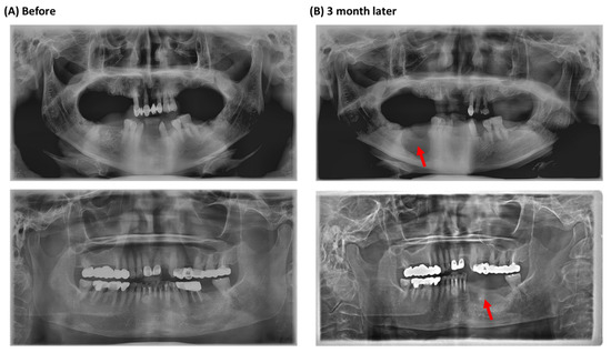 JCM | Free Full-Text | Identification of Potentially Pathogenic ...