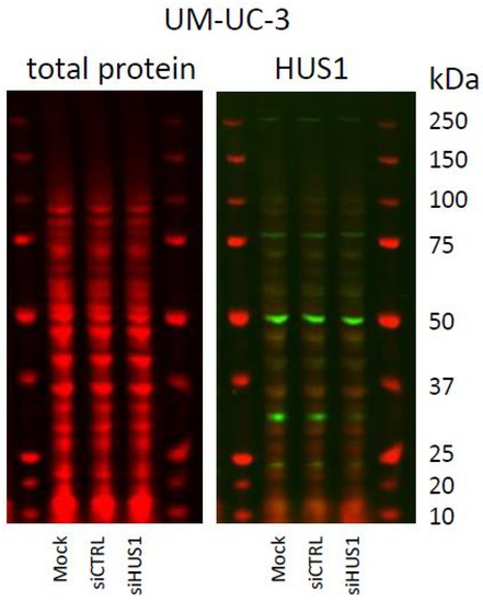 HUS1 as a Potential Therapeutic Target in Urothelial Cancer