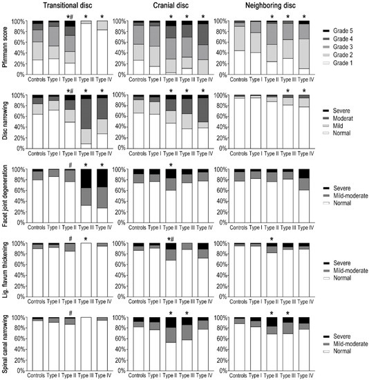 Lumbosacral Transitional Vertebra Contributed to Lumbar Spine ...