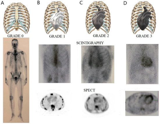 JCM | Free Full-Text | New Advanced Imaging Parameters and Biomarkers—A ...