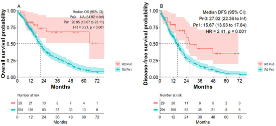 Perineural Invasion in Pancreatic Ductal Adenocarcinoma (PDAC): A ...