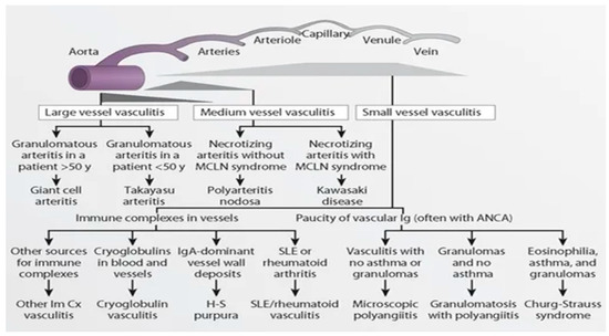 A Comprehensive Update on Retinal Vasculitis: Etiologies ...