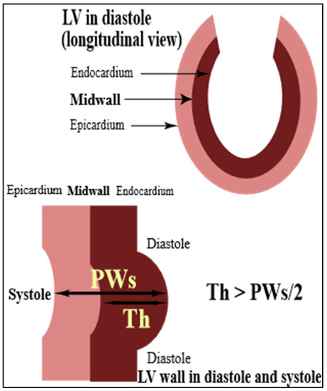 Impaired Left Ventricular Circumferential Midwall Systolic Performance ...