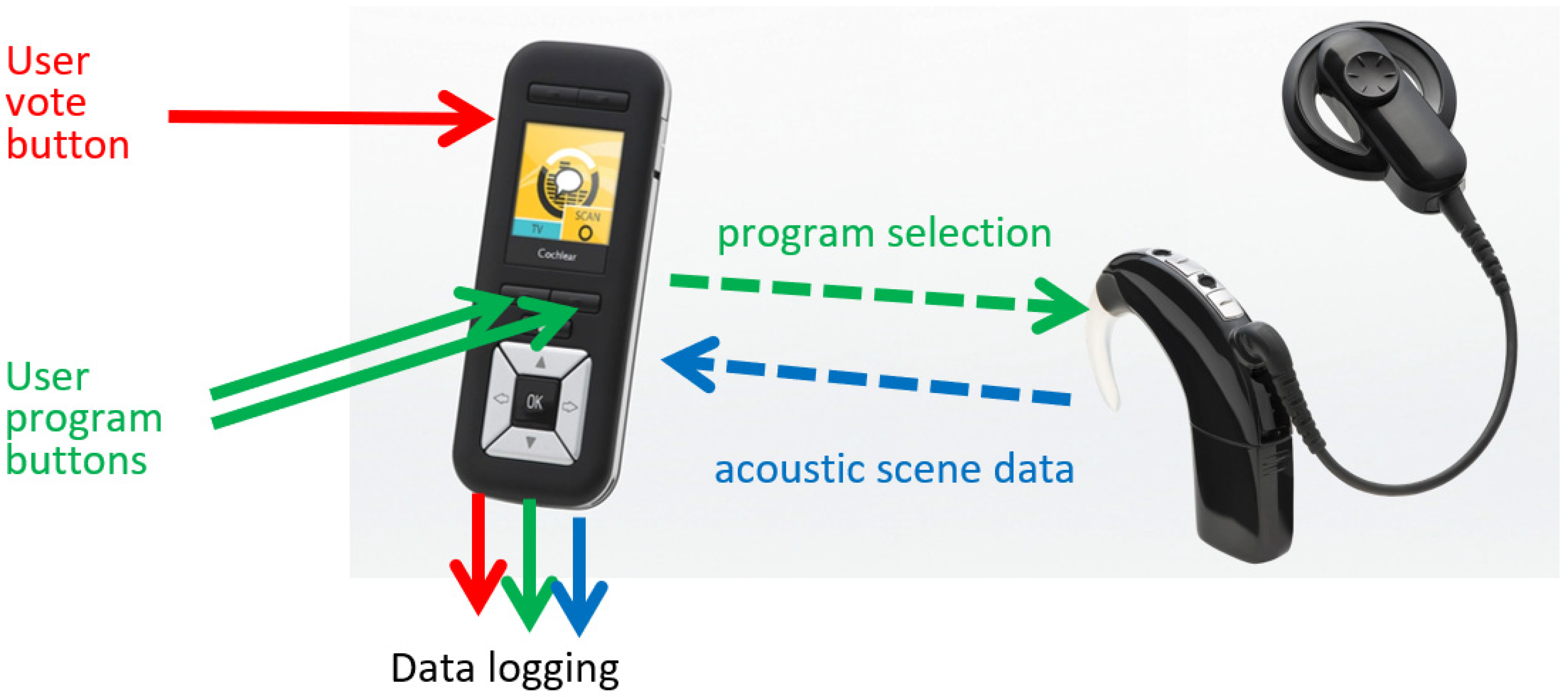Cochlear Nucleus 5 Recall