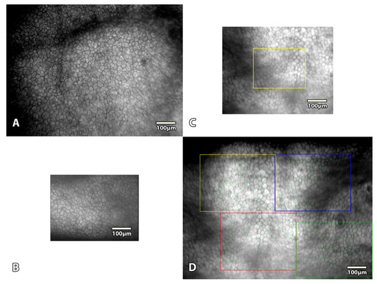 Specular Microscopy of Human Corneas Stored in an Active Storage Machine