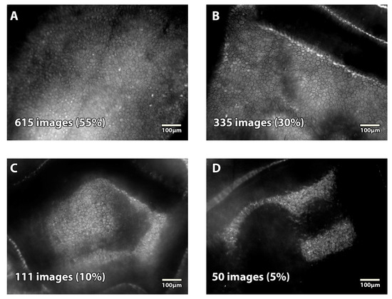 Specular Microscopy of Human Corneas Stored in an Active Storage Machine